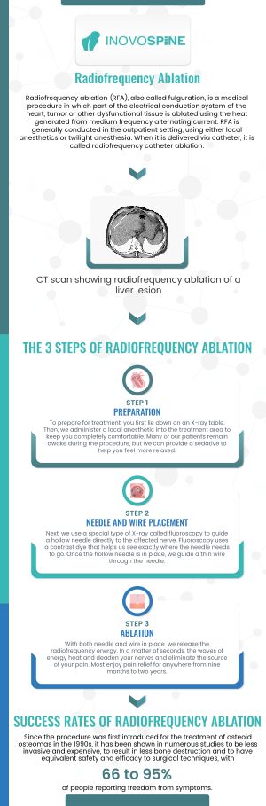 Radiofrequency Ablation Specialist Near Me in Houston, TX